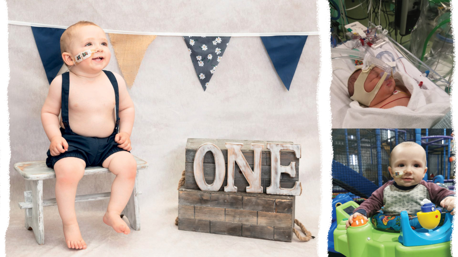 Crawley Family Plead for Help as 1-year-old boy due £140k Heart Surgery ...